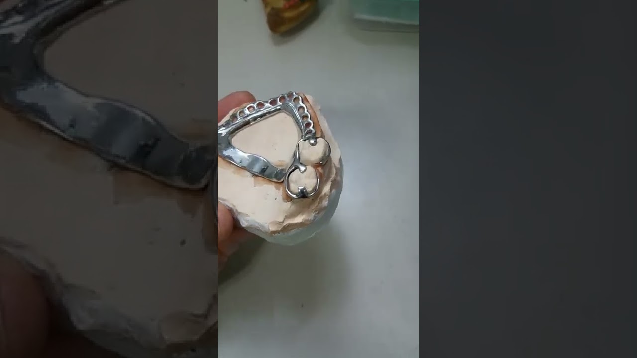 ppr metálica superior ... - YouTube