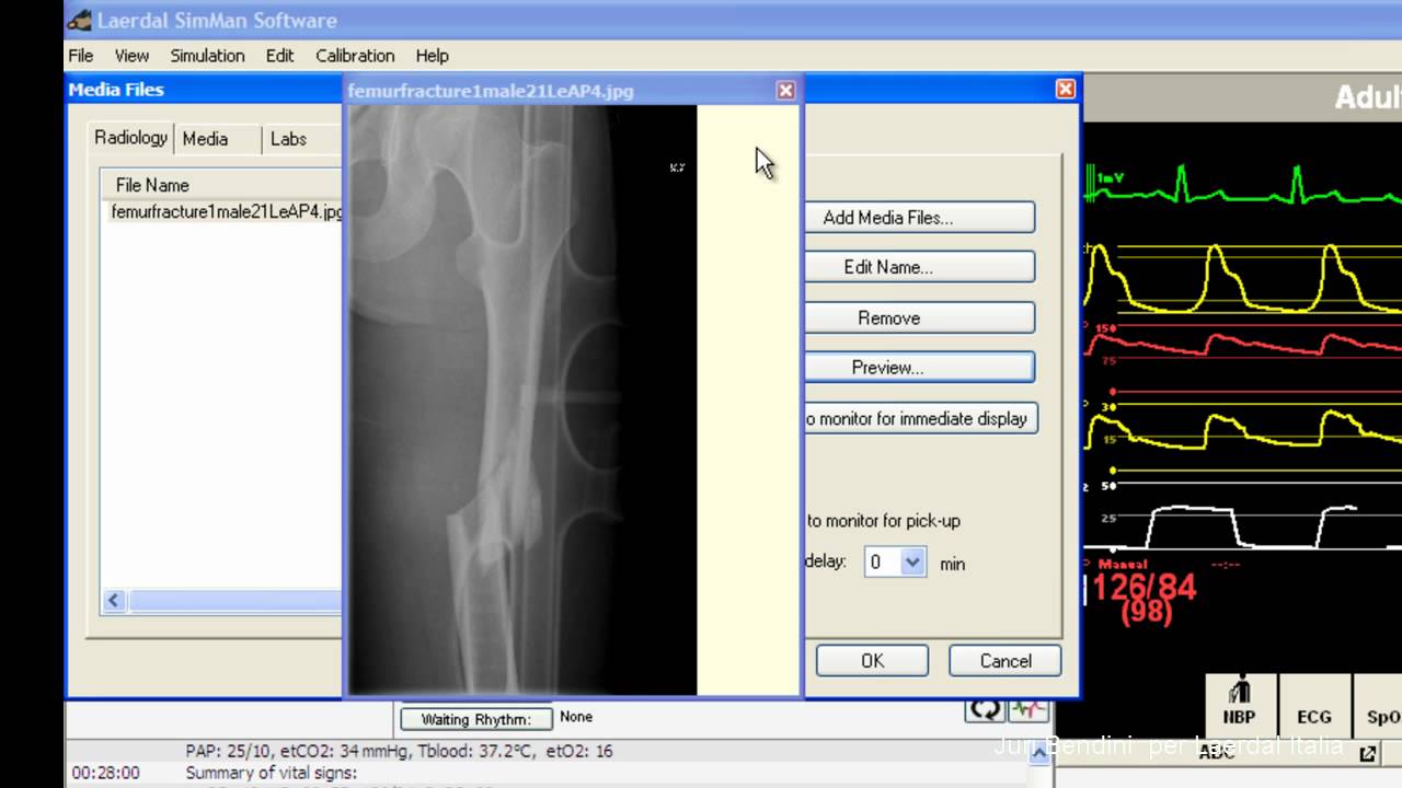 SimMan, SimBaby, SimNewB e ALS Simulator Guida Software - Parte 2 ...
