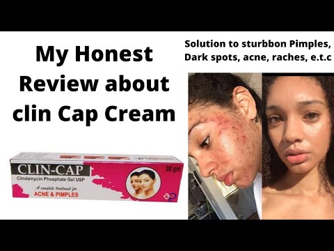 # Honest review:#Clin cap tube cream#solution to stubborn pimples,dark ...