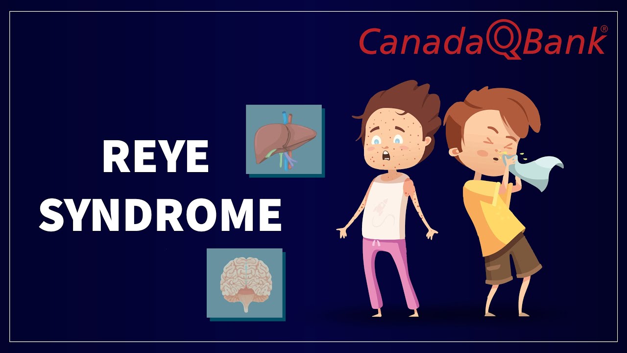 Reye Syndrome - YouTube