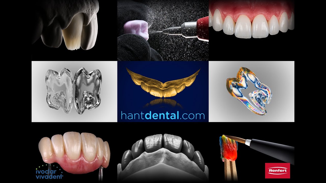 HantDental Renfert Master Lab launch - YouTube