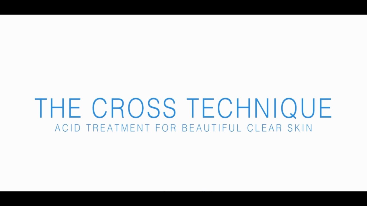 The cross technique, TCA Tricloroacetic acid treatment for acne ...