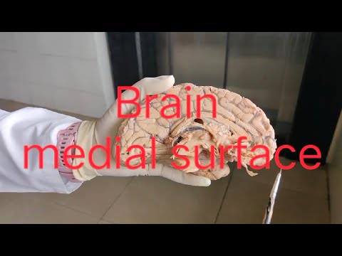 Anatomy of the brain /Anatomy of thr cerebrum # brain #Medial surface ...