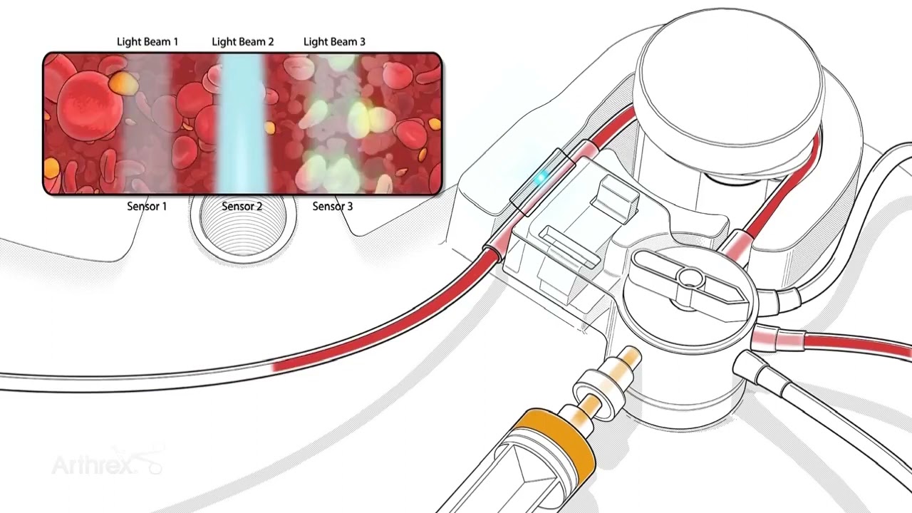 Arthrex Angel System®️ - YouTube