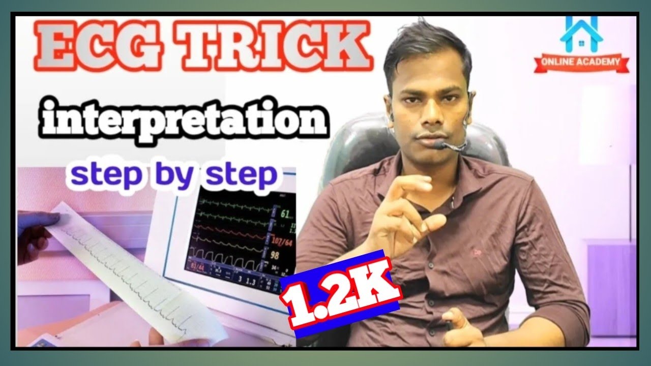 ecg report | ecg trick | ecg test kya hota hai | ecg test kyo hota hai ...