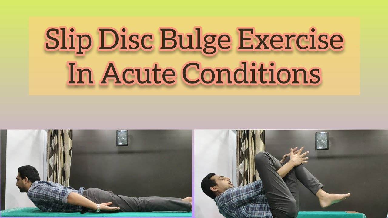 Slip disc exercises, lower Back Treatment in acute stage - YouTube
