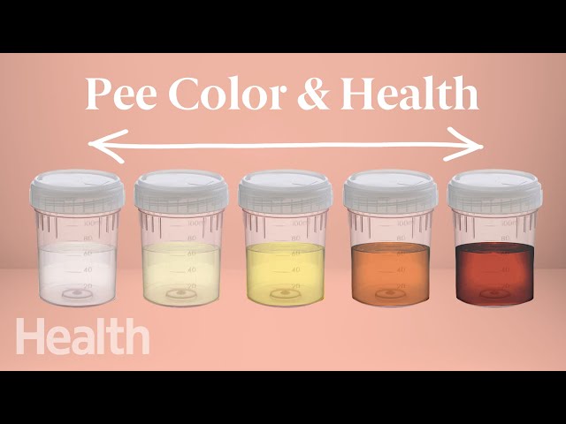 Liver Damage Urine Color - Infoupdate.org