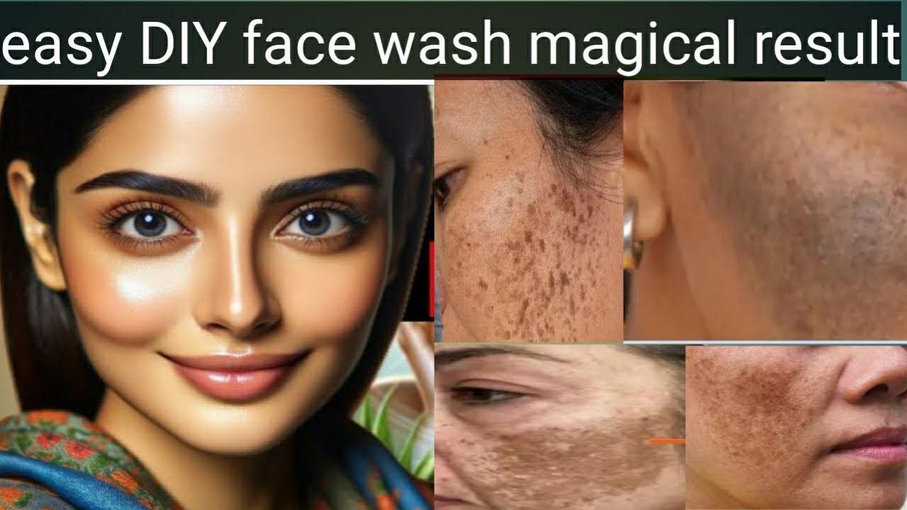 DIY face wash for remove hyperpigmentation ,|| spotless face || hide age sign by parisha Arain ...
