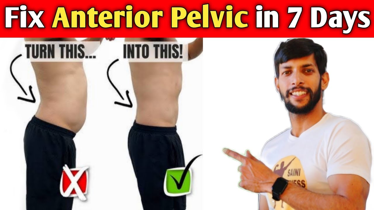 HOW TO FIX ANTERIOR PELVIC TILT | Saini Fitness Home - YouTube
