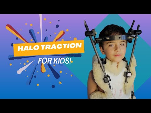 Halo Traction Brace: Basic Info For Kids. - YouTube