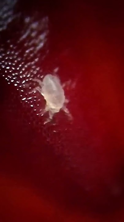 Strawberries 🍓 Under The Microscope Microbes Microbiology Shorts