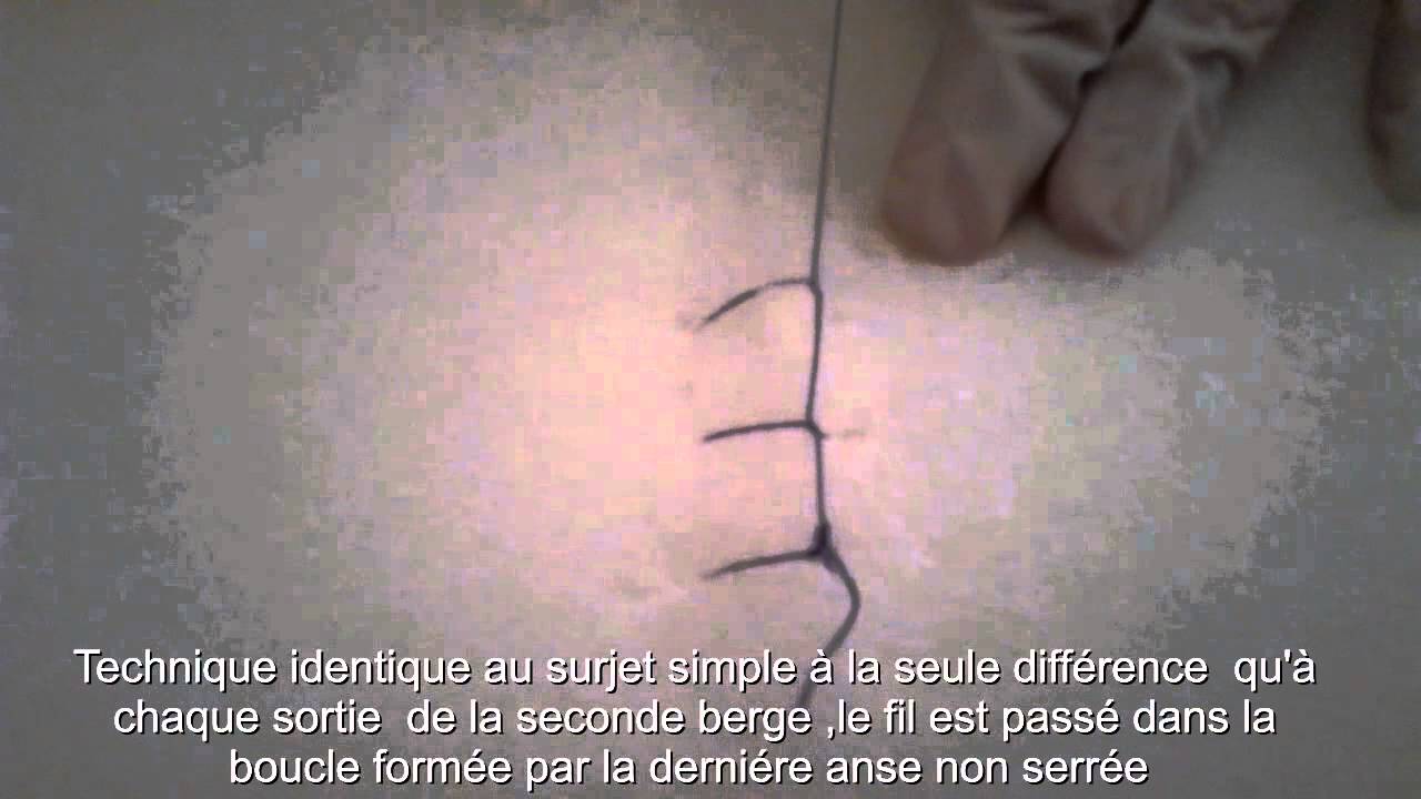 Surjet de reverdin - YouTube