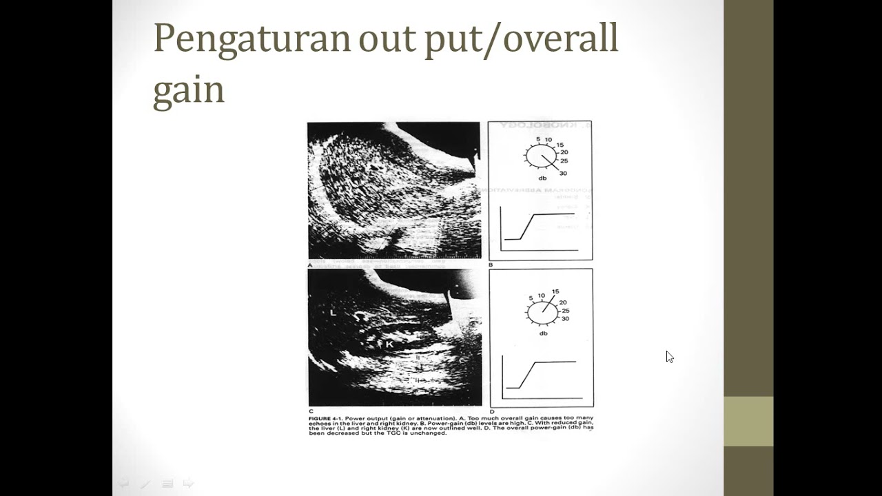 Komponen Dasar USG / Ultrasonografi - YouTube