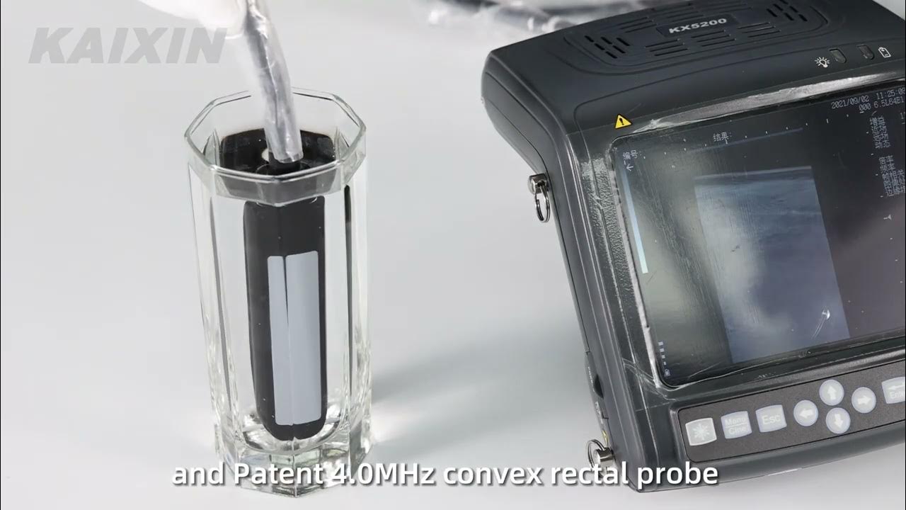 Ультразвуковой аппарат KX5200 KAIXIN - YouTube