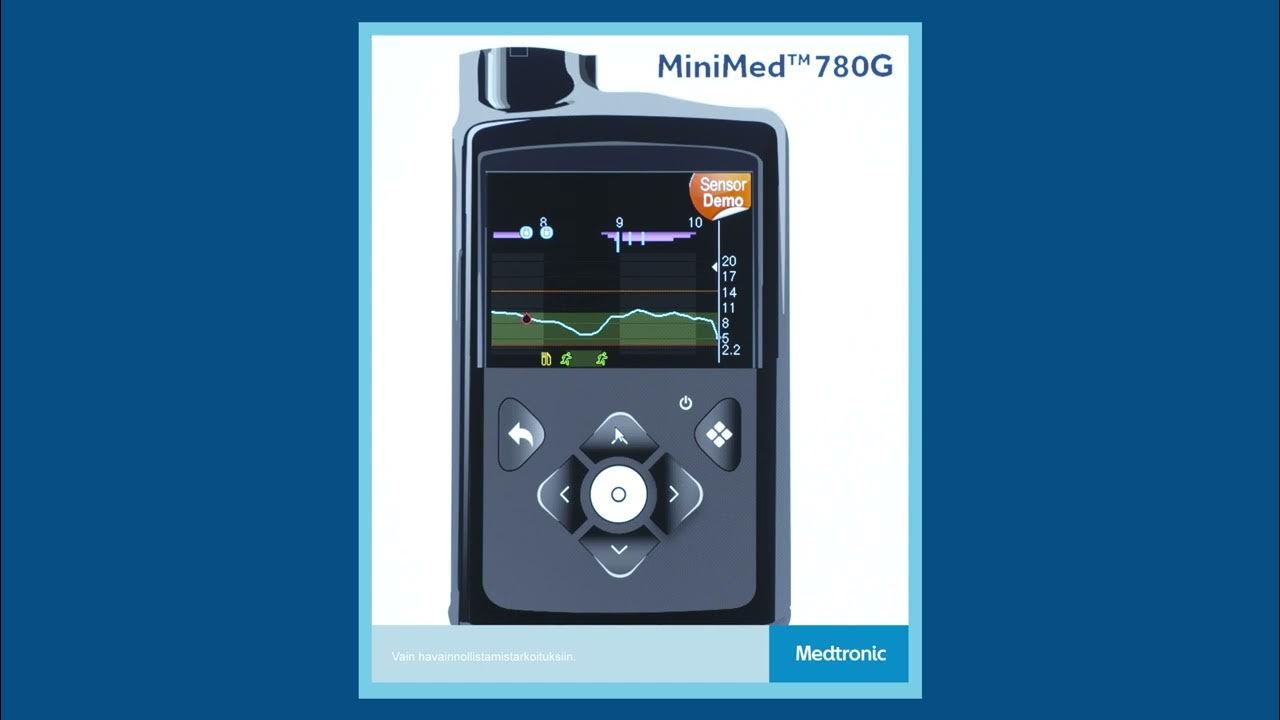 Medtronic MiniMed™ 780G -järjestelmän tekninen käyttöönotto– SmartGuard™-ja sensoritietojen ...