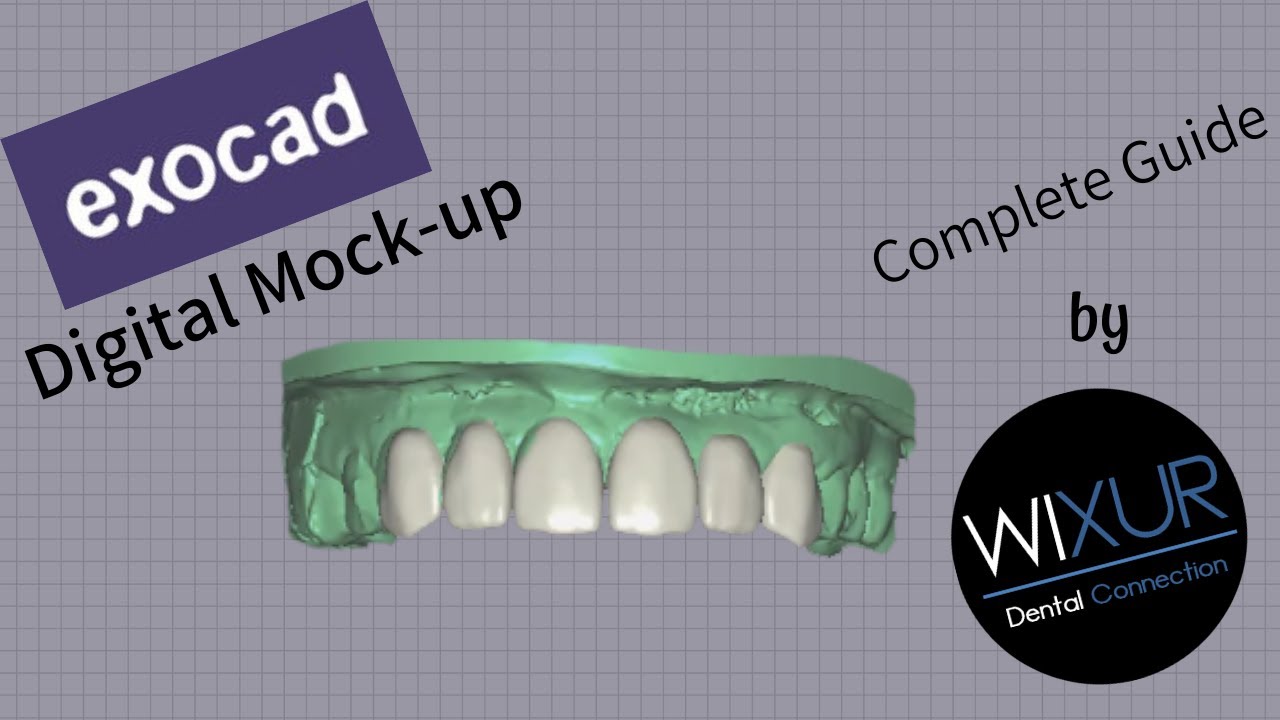 Exocad - Digital Mock-up - YouTube