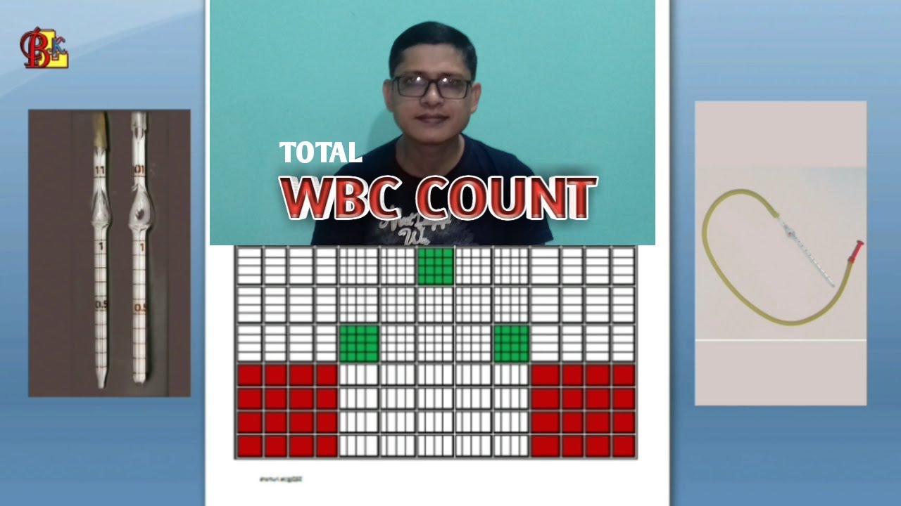 How to Total WBC Count of CBC Test? - YouTube