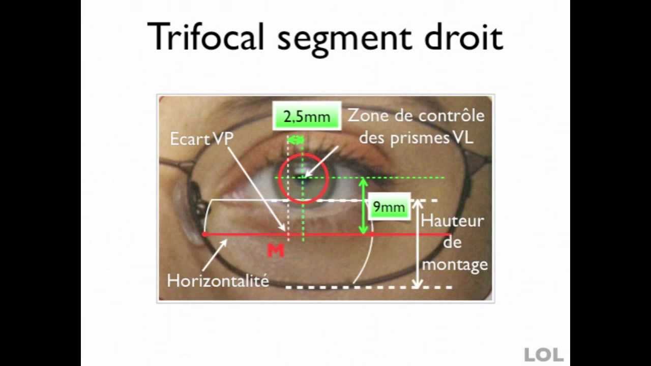 Bts OL Contrôle Trifocal - YouTube