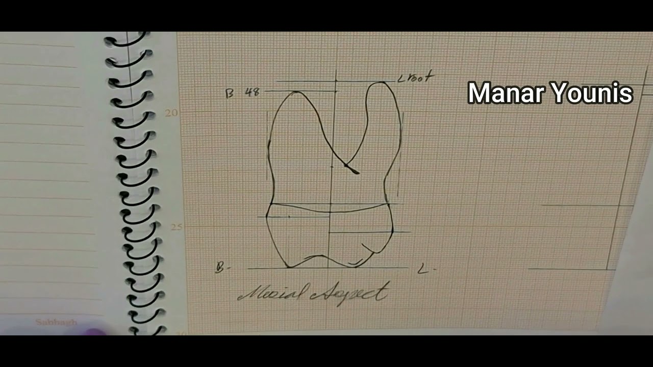 Drawing Maxillary Right first Molar Part 2 mesial, distal and occlusal ...