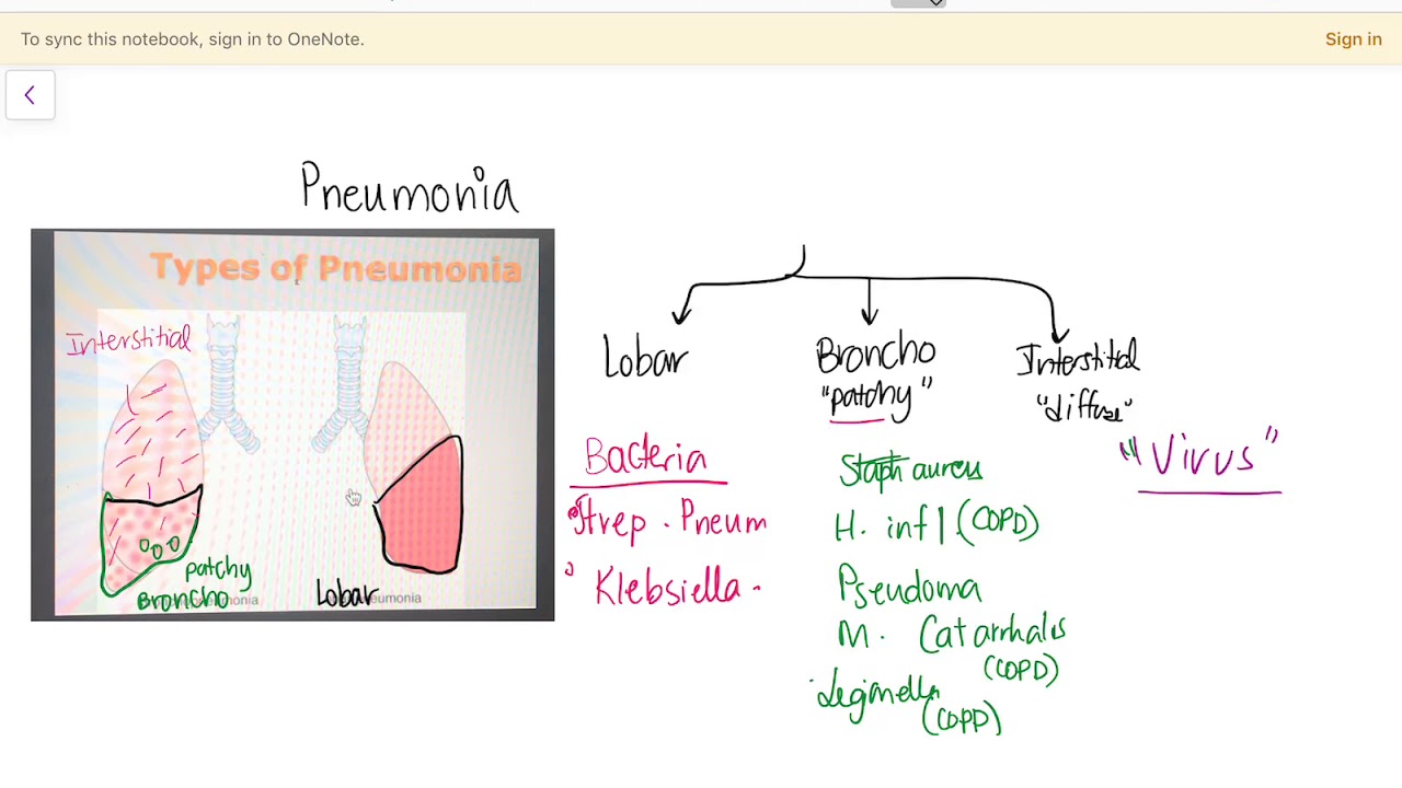 Classification Of Pneumonia
