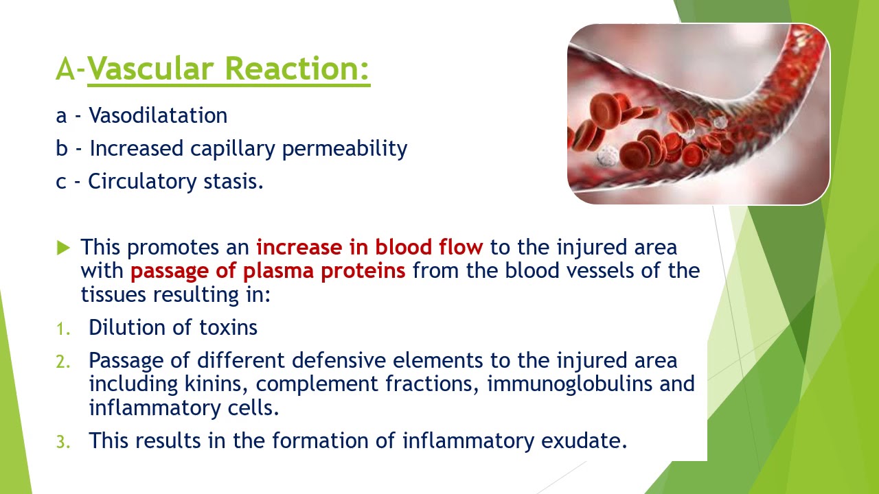 Fall 2020 ; Periodontology 1 ; Lec 3 ; Pathogenesis of PDL (Part 1 ...