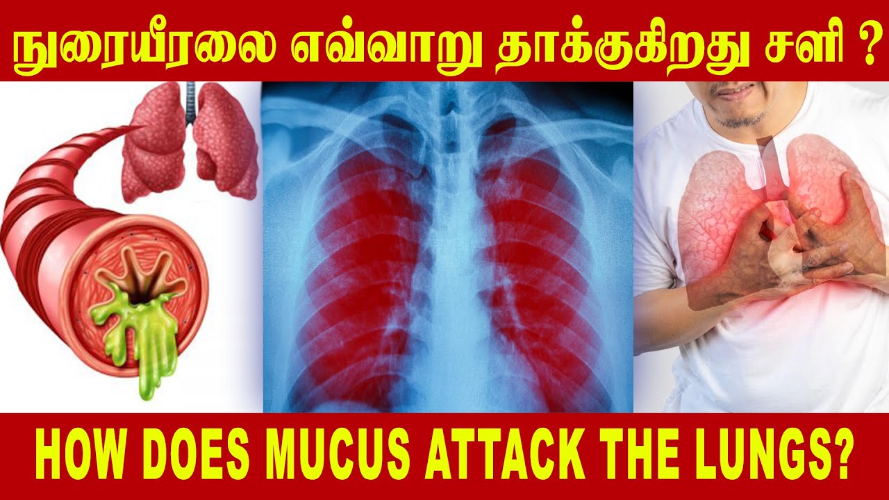 நுரையீரலை சளி எவ்வாறு தாக்குகிறது? | How does mucus attack the lungs ...