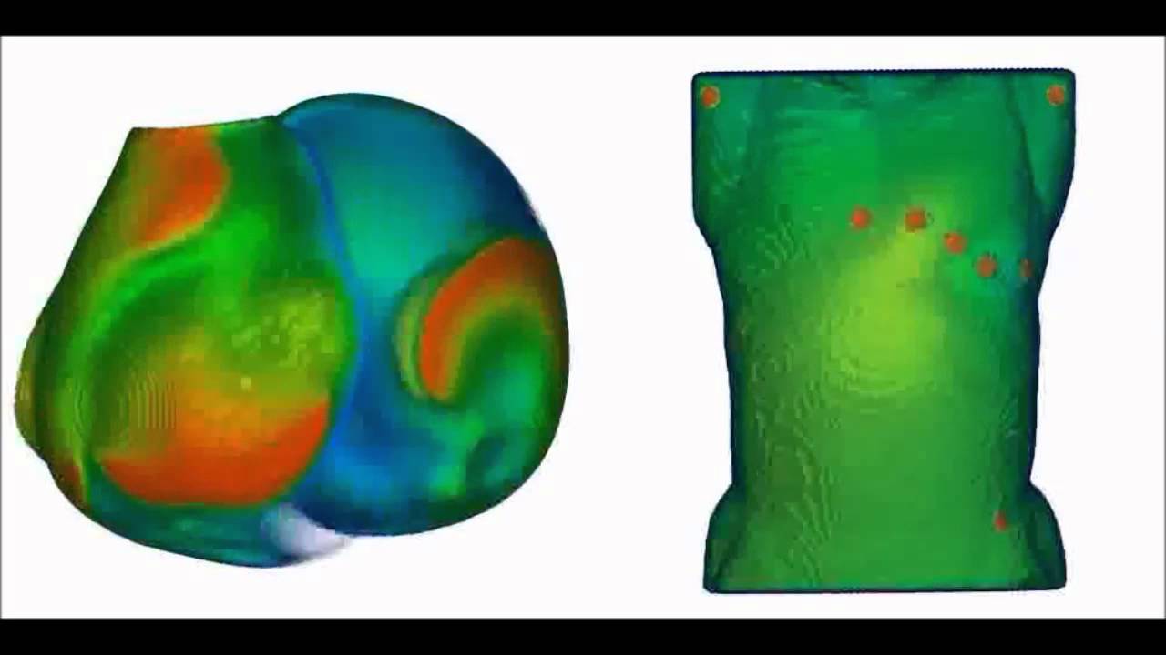 Screening system for drug-induced arrhythmogenic risk combining a patch ...