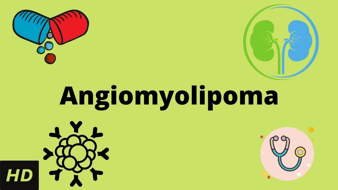 Angiomyolipoma, Causes, Signs and Symptoms, Diagnosis and Treatment ...