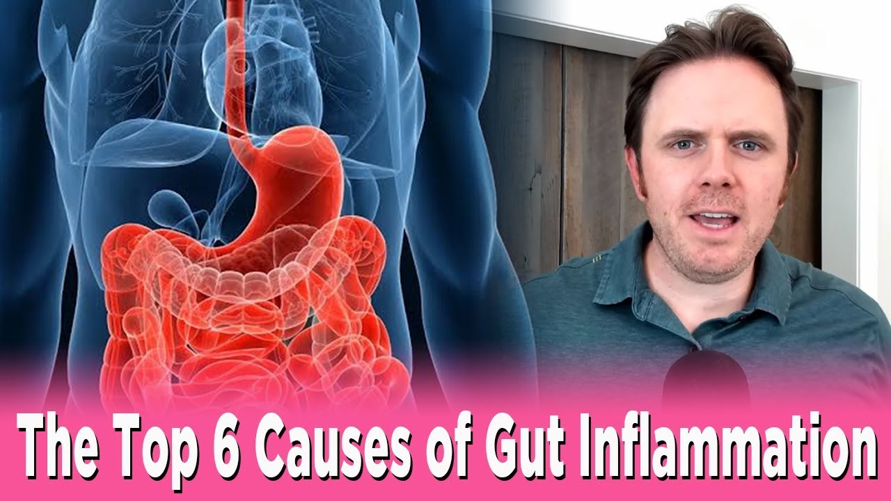The Top 6 Causes of Gut Inflammation | Dr. J Q & A - YouTube