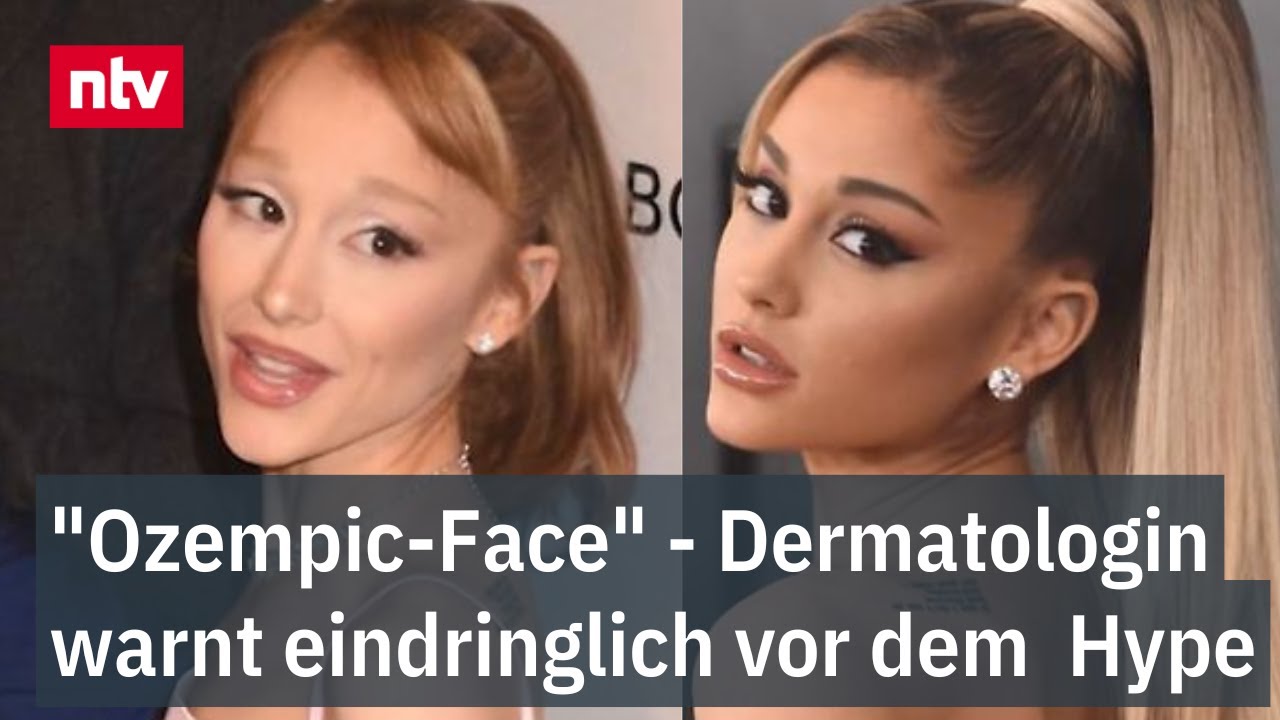 "Ozempic-Face" - Dermatologin warnt eindringlich vor dem Hype - YouTube