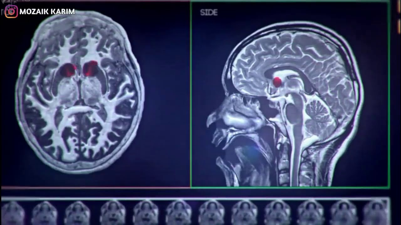Astagfirullah, beginilah kerusakan otak jika kita kecanduan menonton ...