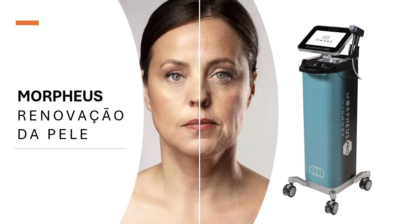 MORPHEUS - e os benefícios para a sua pele! - YouTube