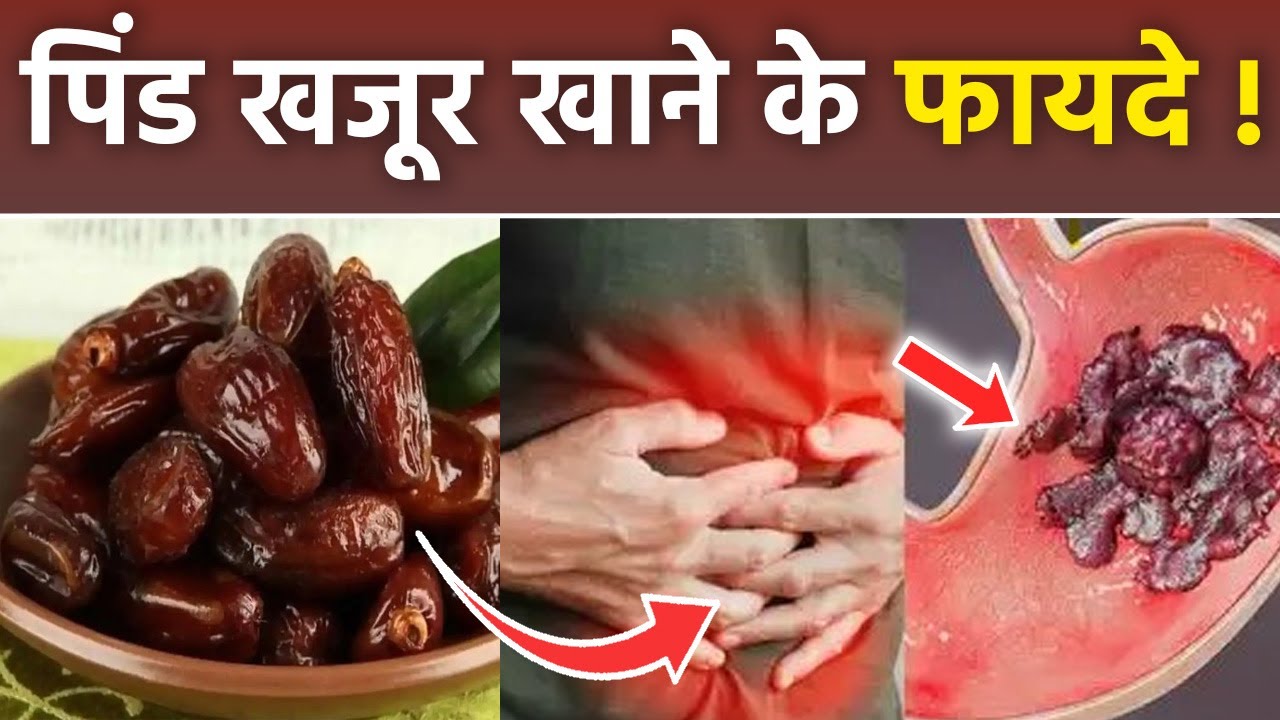 Pind Khajur Benefits In Hindi: पिंड खजूर खाने के फायदे, किन लोगों को ...