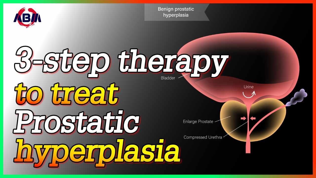 3 Step Therapy for Chronic Prostatic Hyperplasia, Enlarged Prostate ...