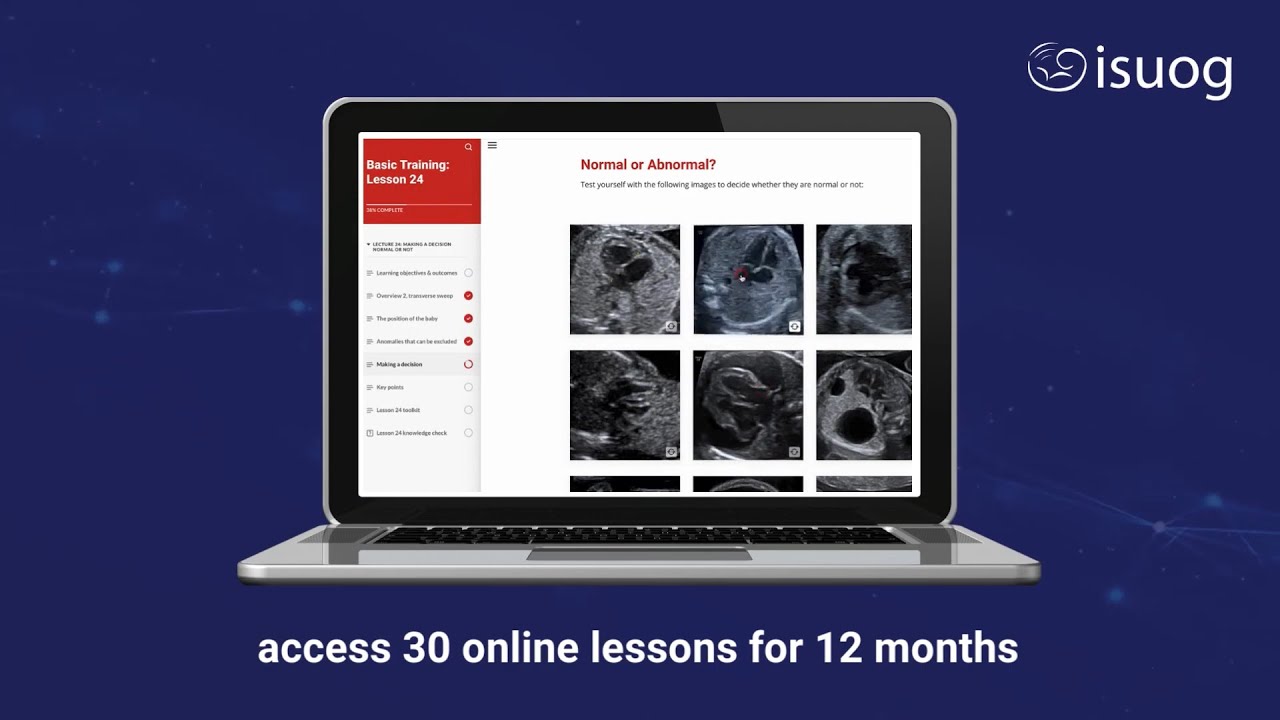 ISUOGs New Basic Training Online Program - YouTube