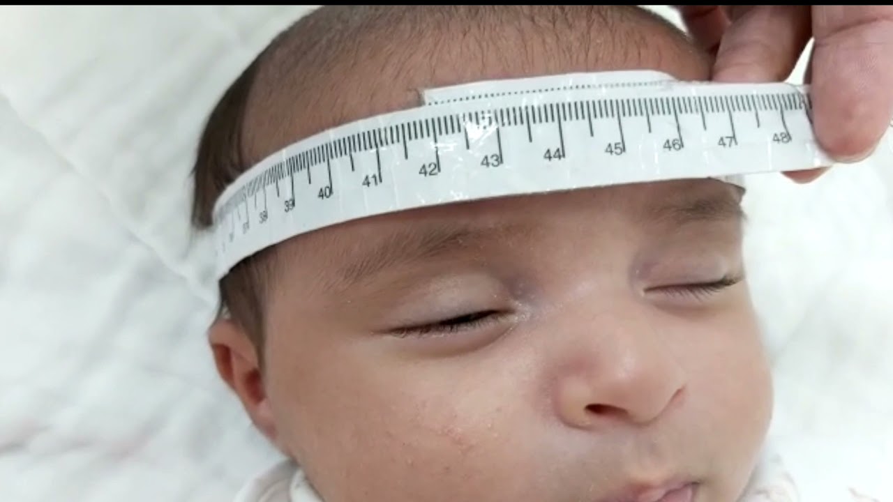 Case 627 How to approach for large head ? macrocephaly, familial ...