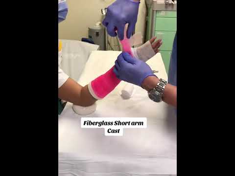 Fiberglass Short arm cast - YouTube