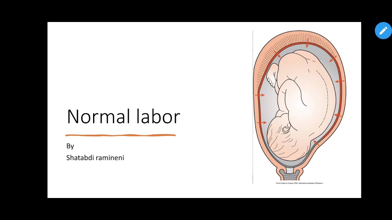 management of normal labor obstetrics and gynecology - YouTube