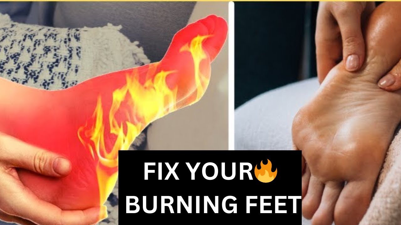 🔥Burning Legs And Burning Feet Treatment and Herbs That Can Help🔥 - YouTube