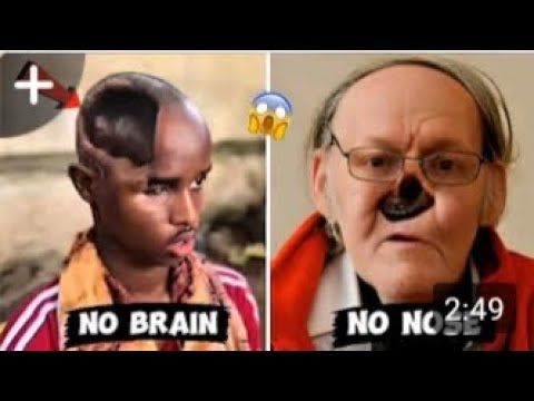 Unique People With Missing Body Parts 😮😮😦 - YouTube