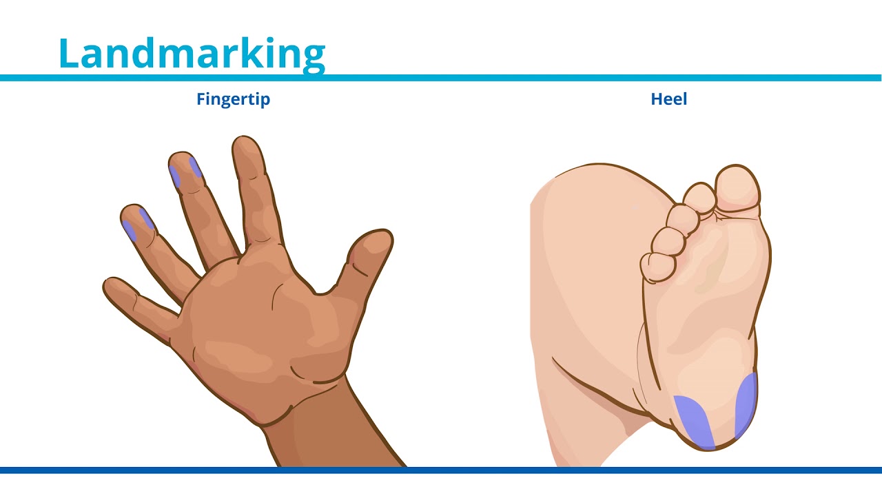 How to do Dried Bloodspot Monitoring - YouTube