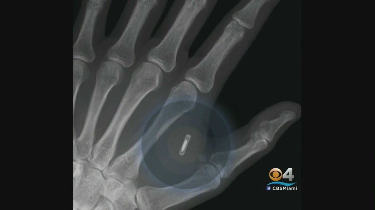 Bio Hacking: Modifying The Body For Everyday Conveniences - YouTube