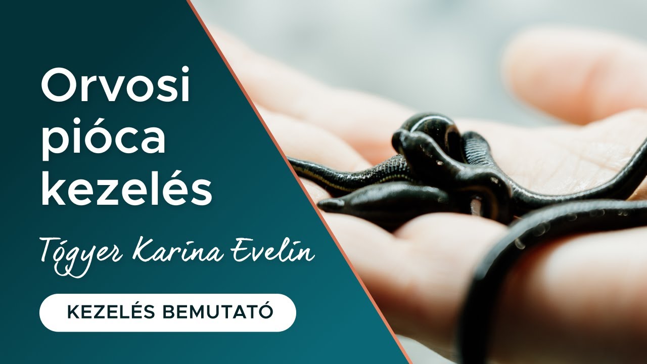 Orvosi pióca kezelés - kezelésbemutató Tógyer Karinával - YouTube