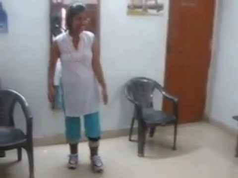 Artificiallimb- B/L Below knee amputee with her new legs-09837224144 ...
