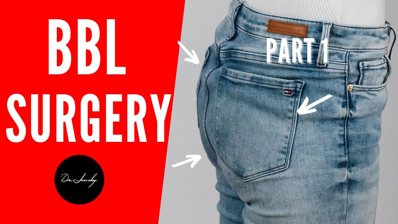 PART 1 Brazilian Butt Lift Surgery | BBL Surgery San Antonio | BBL ...