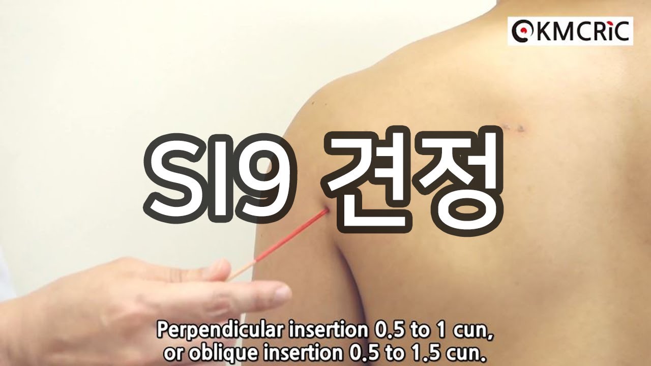 SI9 견정 肩貞 Jianzhen (Eng sub) - KMCRIC WHO Standard acupoint DB - YouTube