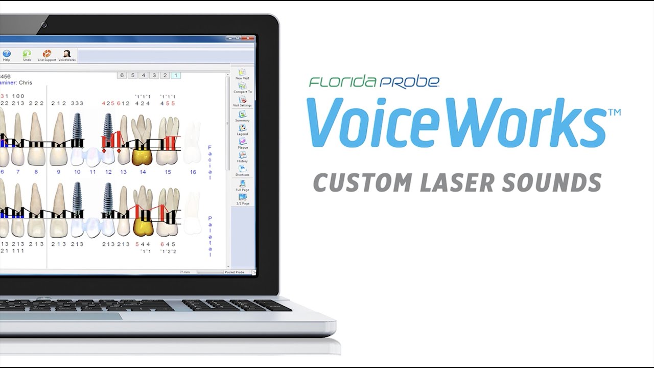 VoiceWorks - Custom Laser Sounds - YouTube