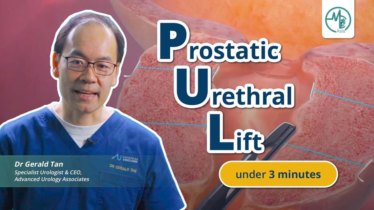 DON'T Get Prostatic Urethral Lift (PUL) Before You Watch This Video ...