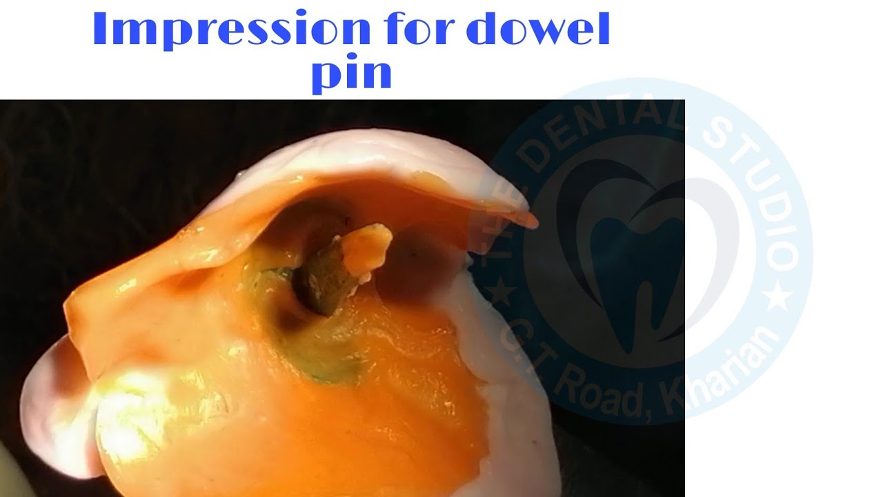 Dowel pin impression/canal prep for dowel pin impression/the Dental ...