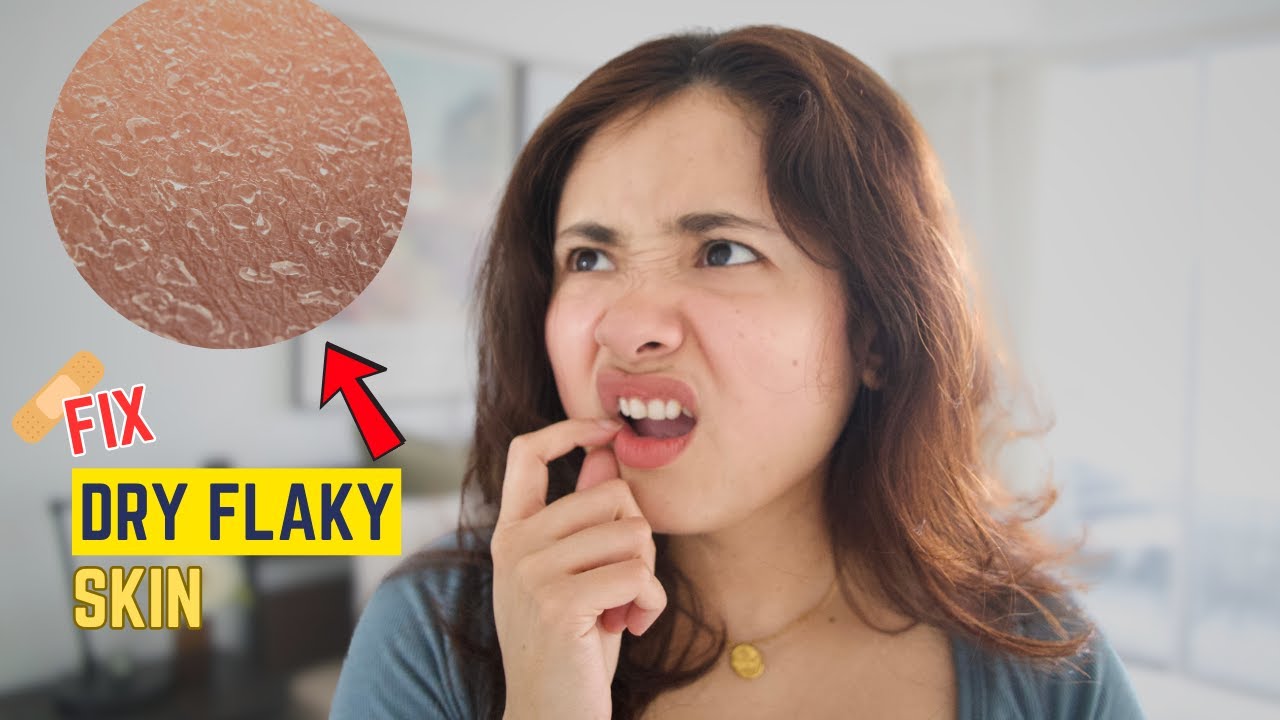 Why Your Skin is SO Dry and Flaky – Skincare Professional Explains ...